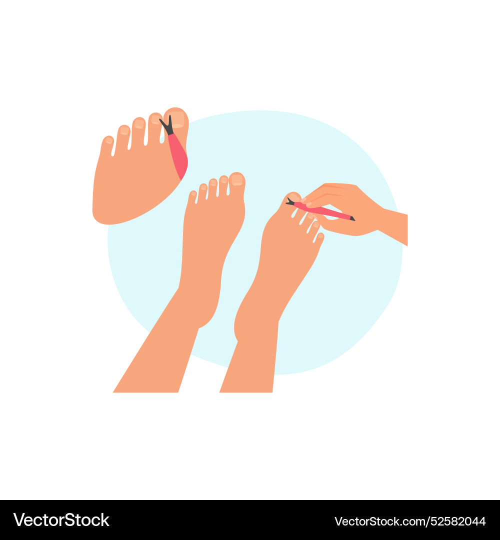 Foot cuticle removal procedure pedicure process Vector Image