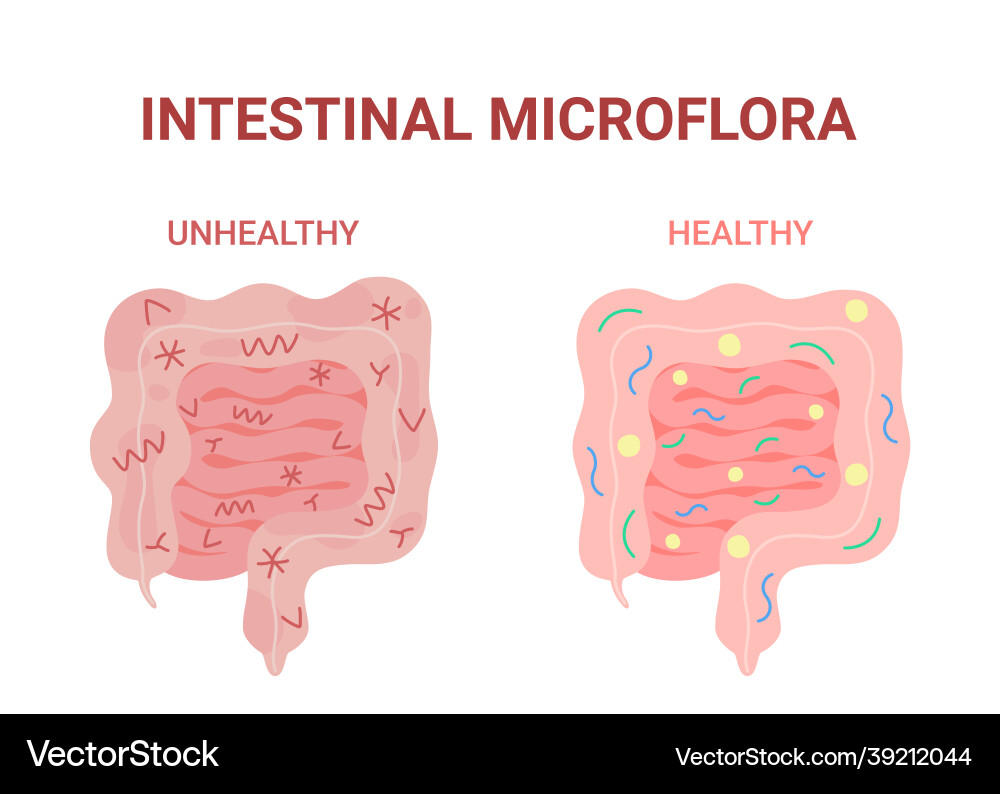 Healthy and unhealthy microflora intestinal good Vector Image