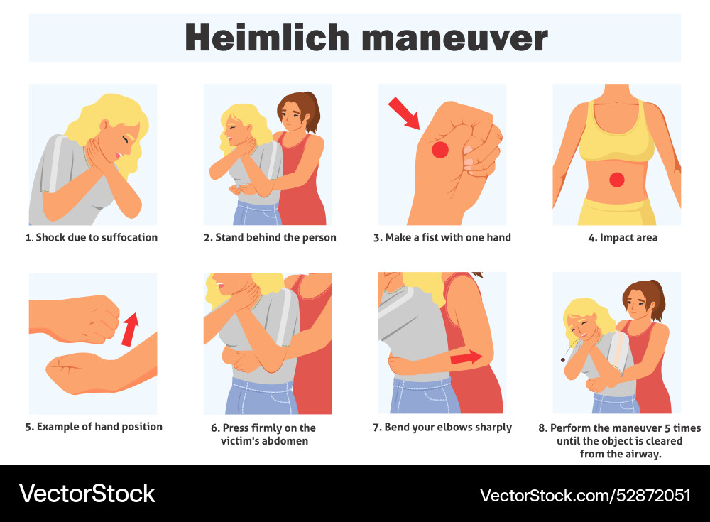 Heimlich maneuver infographic poster with steps Vector Image