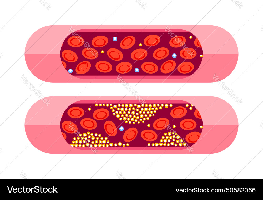 Types of cholesterol hdl and ldl Royalty Free Vector Image