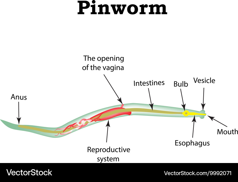 Structure of pinworms pinworm Royalty Free Vector Image