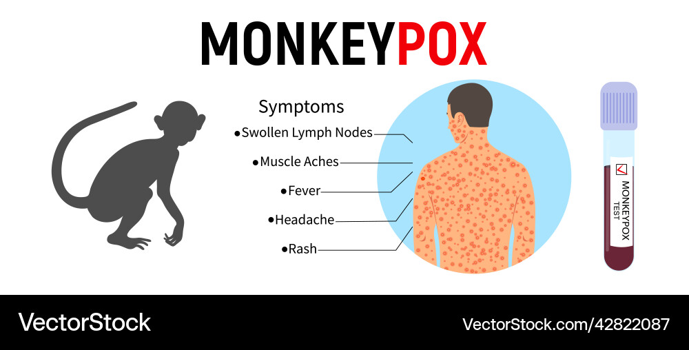 Monkeypox Vector Images (over 1,200)