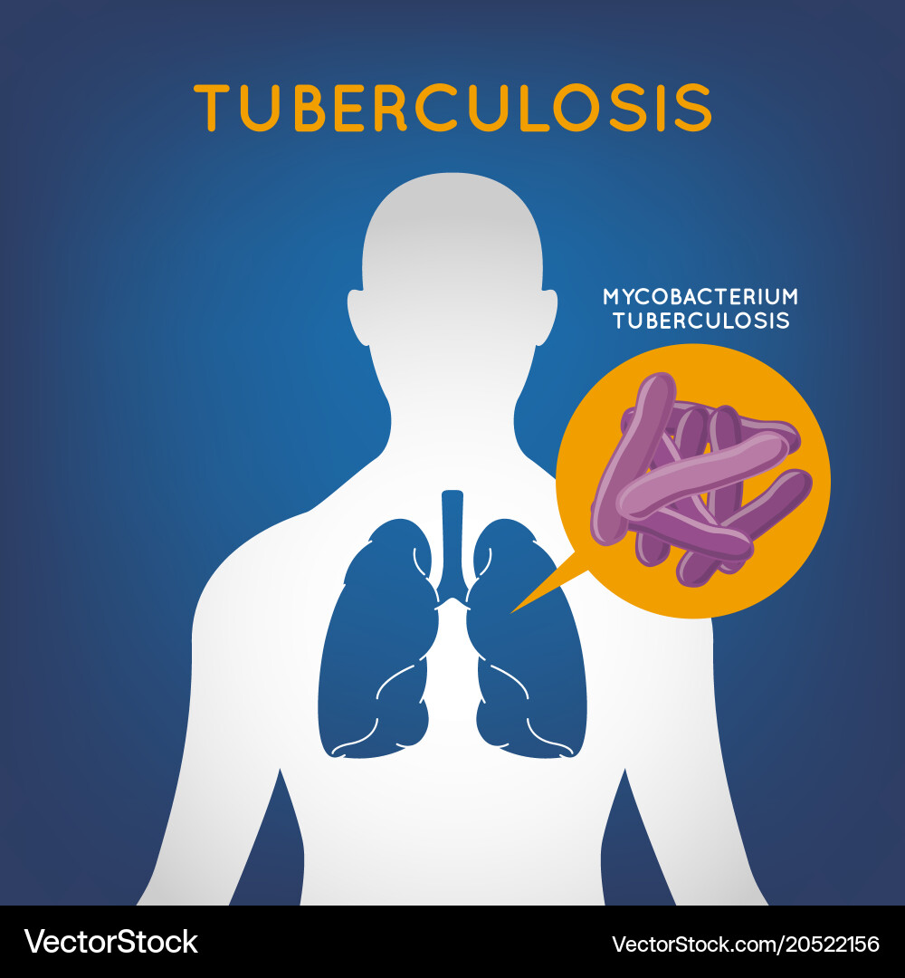 Tuberculosis Logo Icon Royalty Free Vector Image