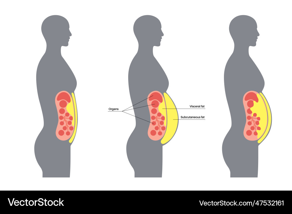Visceral Fat Anatomy Diagram Royalty Free Vector Image