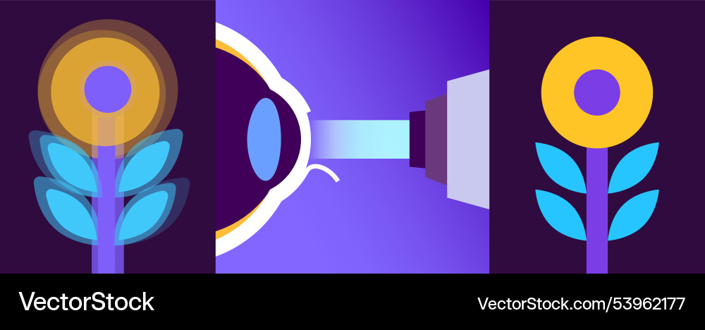 Lasik eye surgery Royalty Free Vector Image - VectorStock