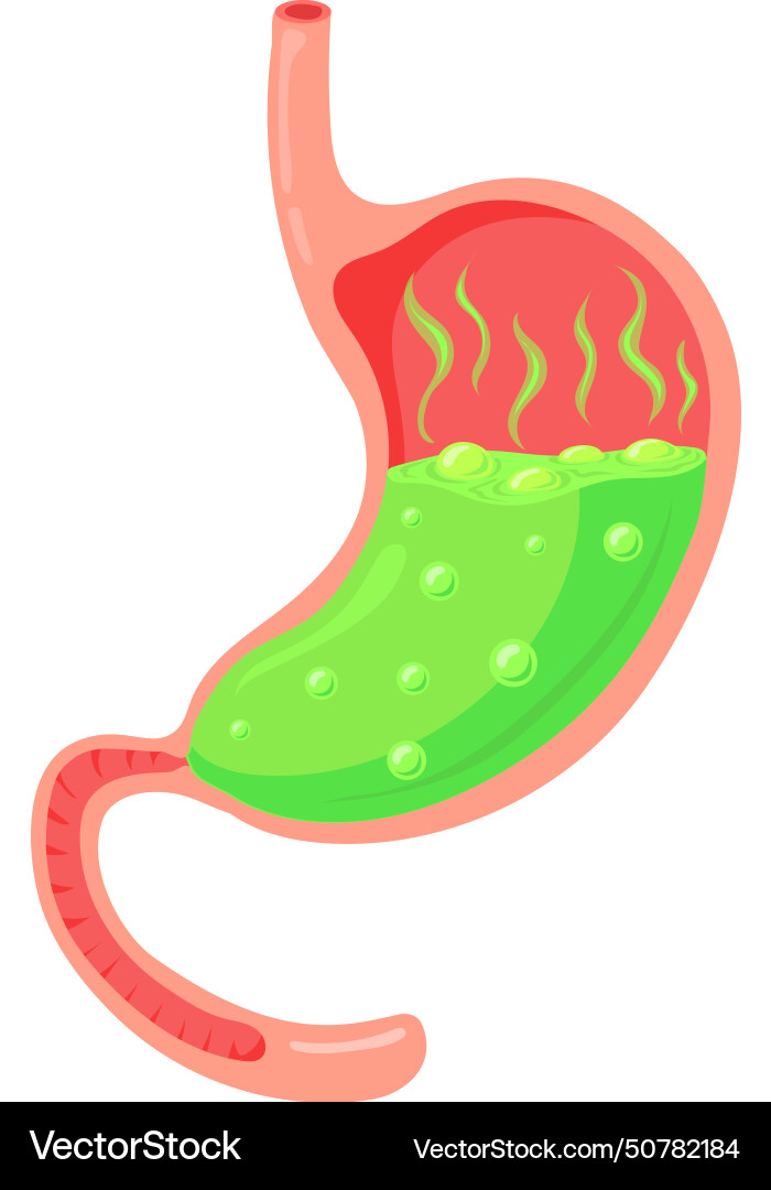 Acid stomach reflux symptome digestive pain Vector Image