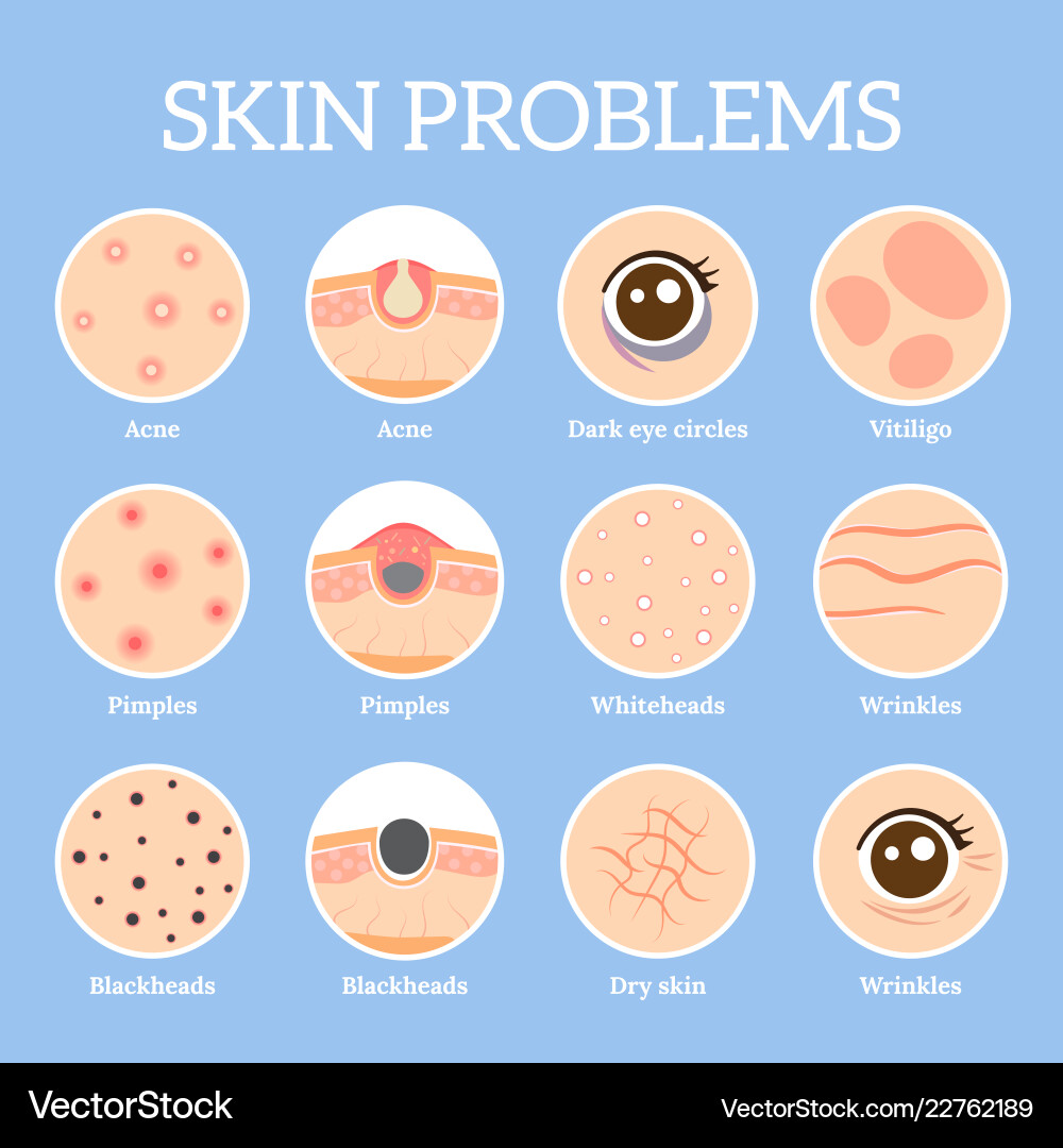 Skin problems ages wrinkles problem face Vector Image