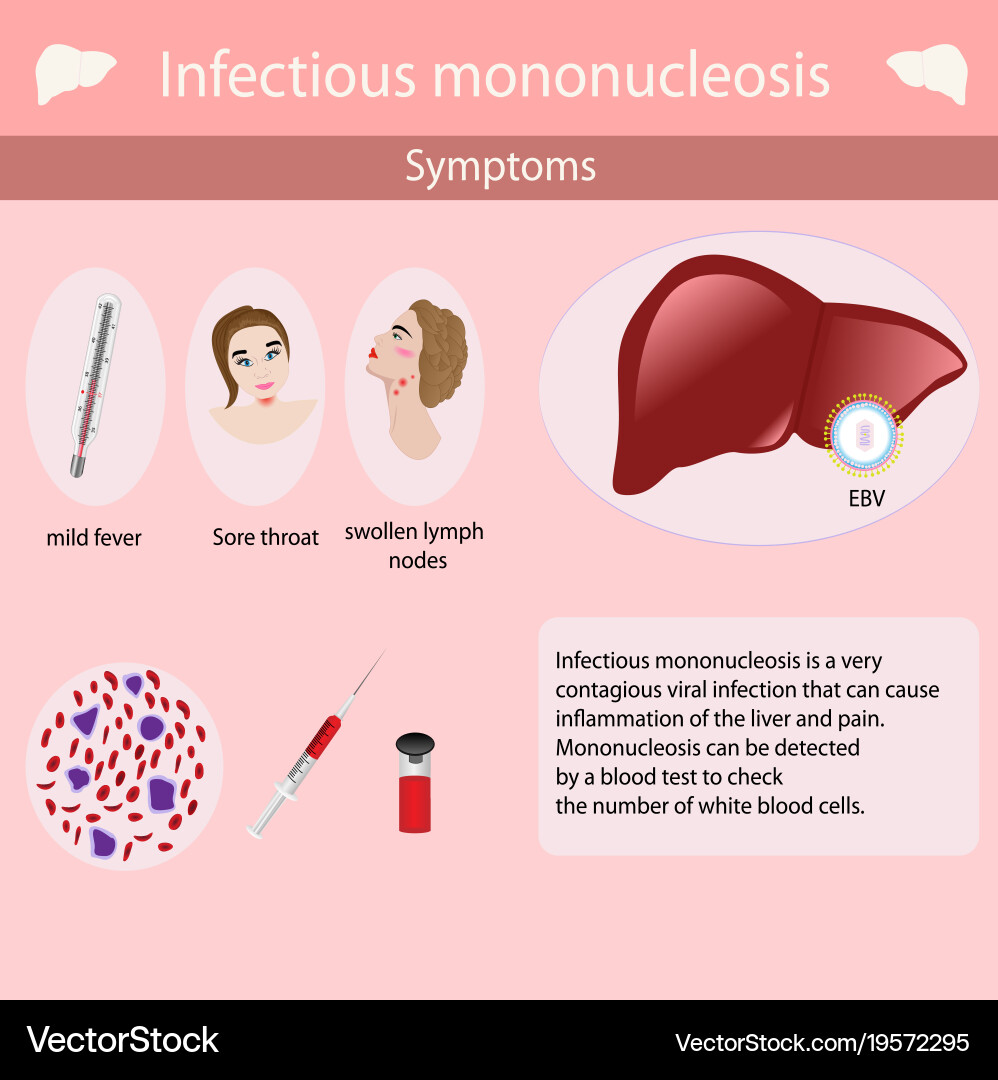 Infectious Mononucleosis Symptoms Royalty Free Vector Image