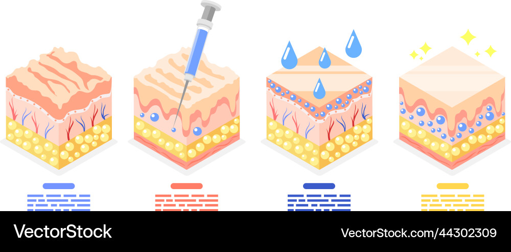 Skin injections isometric set Royalty Free Vector Image
