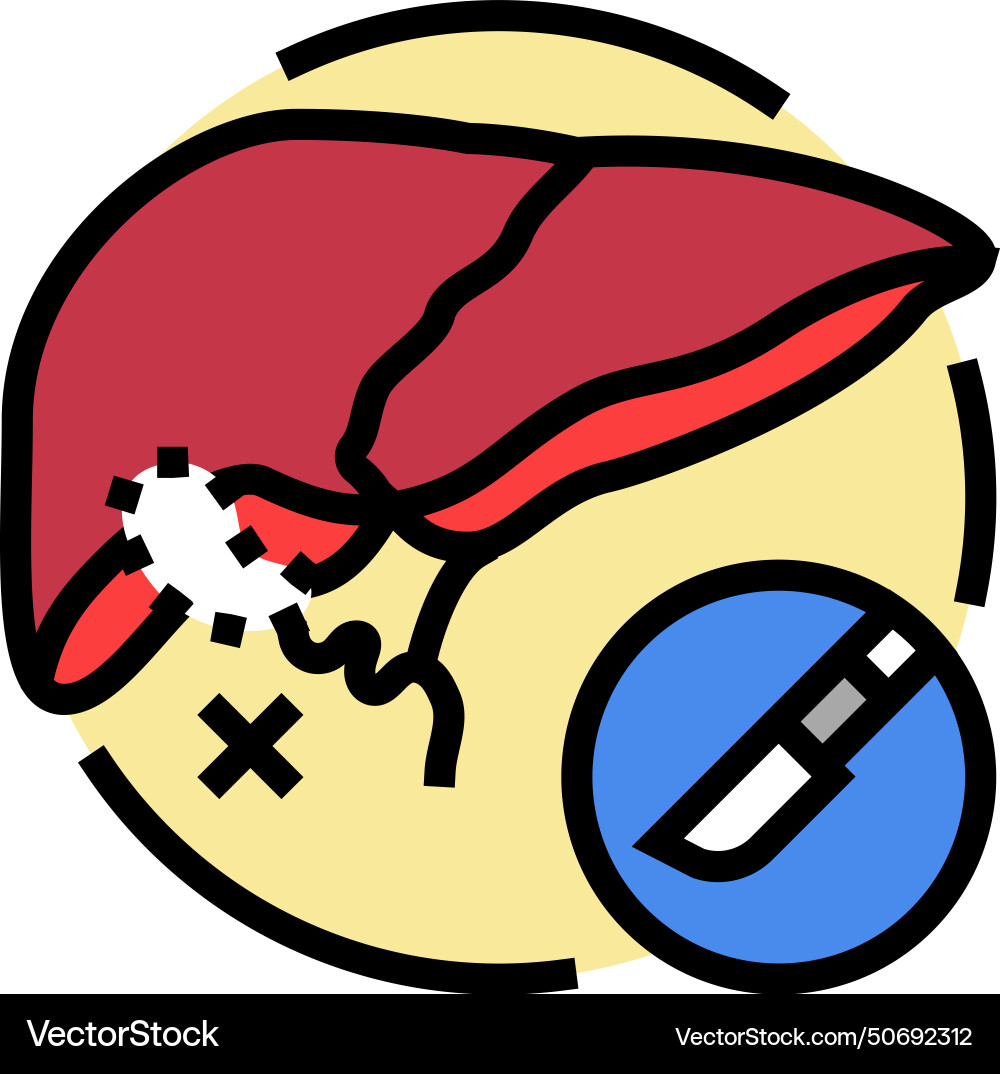 Cholecystectomy surgery color icon Royalty Free Vector Image