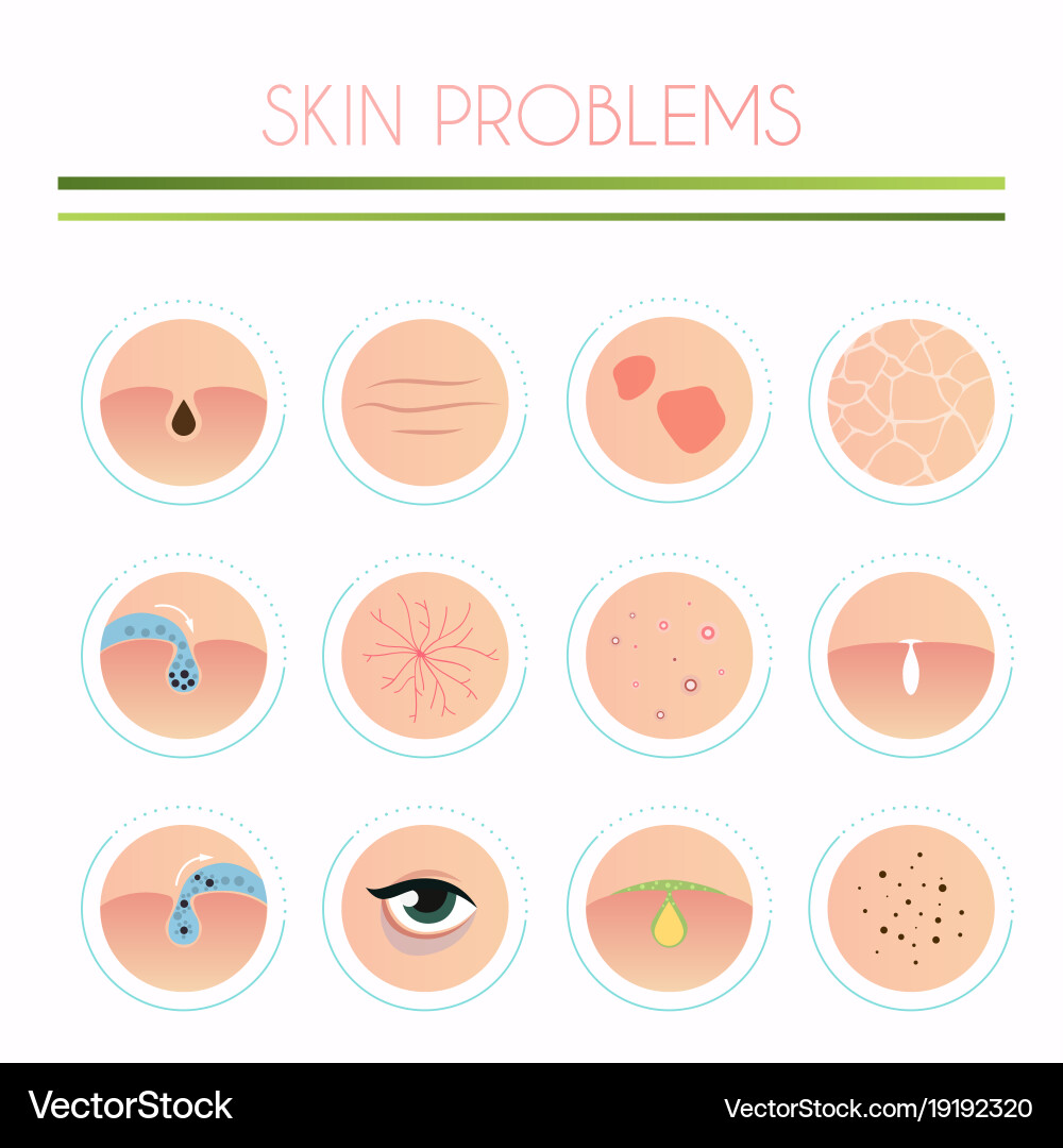 Skin problems solution home remedies skincare Vector Image