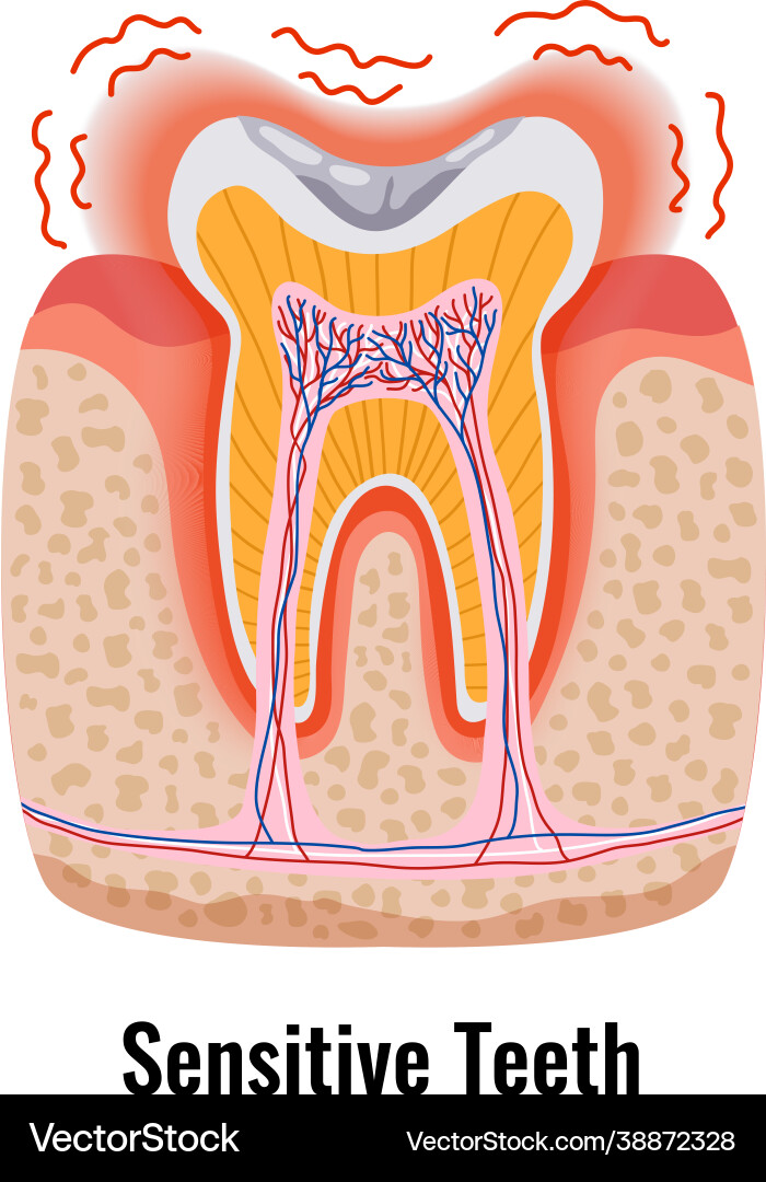 Dental problem poster Royalty Free Vector Image