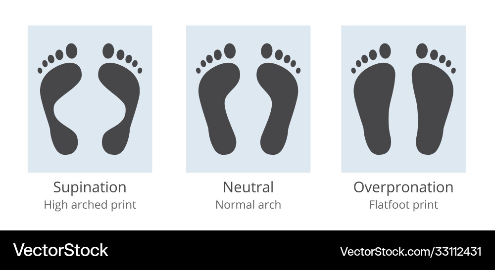 Foot arch variation diagram - supination Vector Image