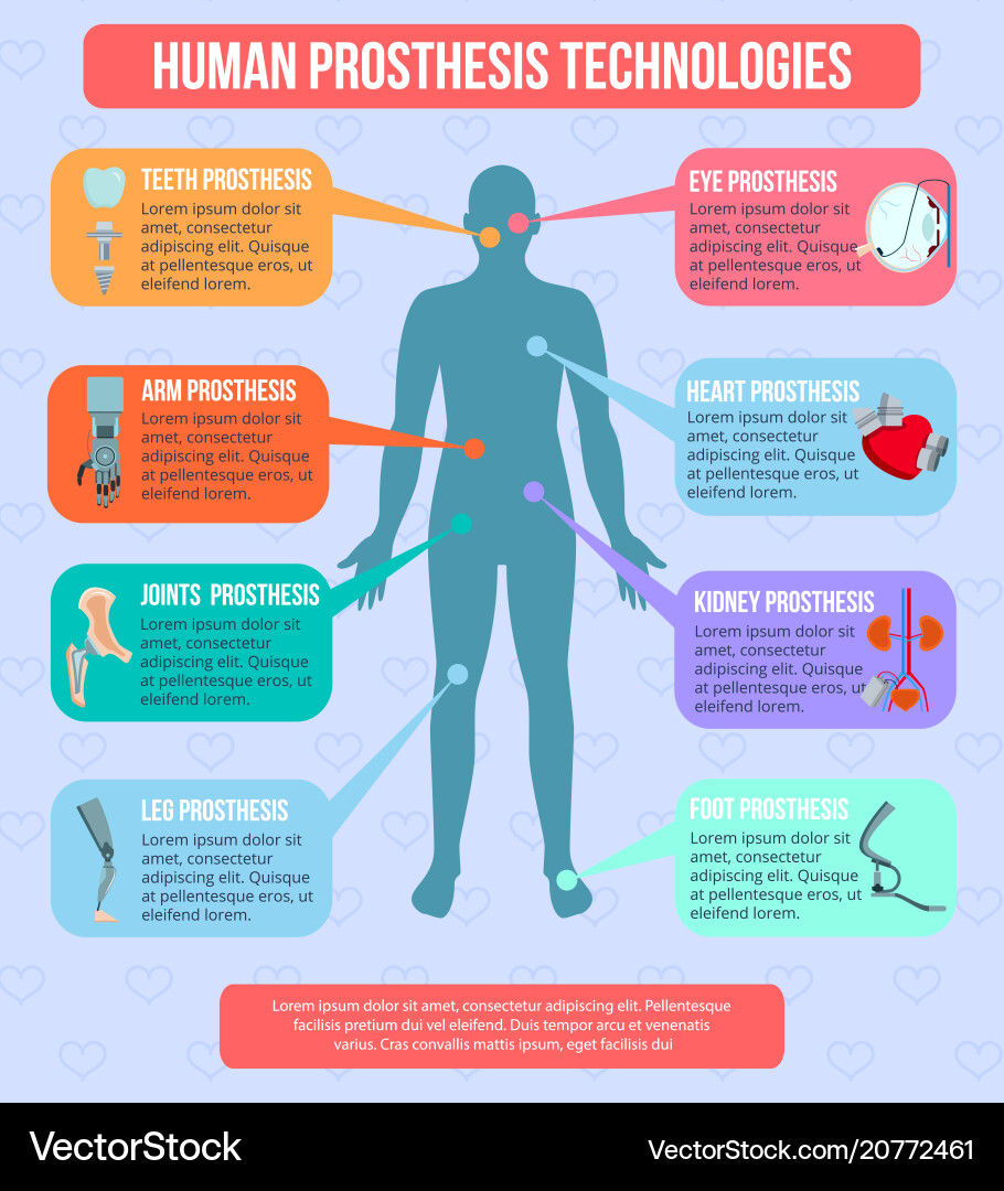 Human prothesis technologies infographics Vector Image