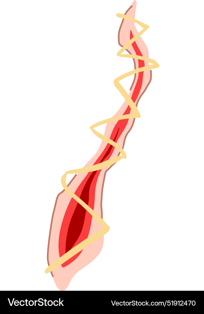 Wound suture cartoon Royalty Free Vector Image