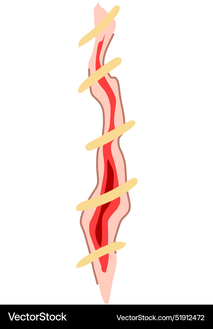 Surgery suture cartoon Royalty Free Vector Image