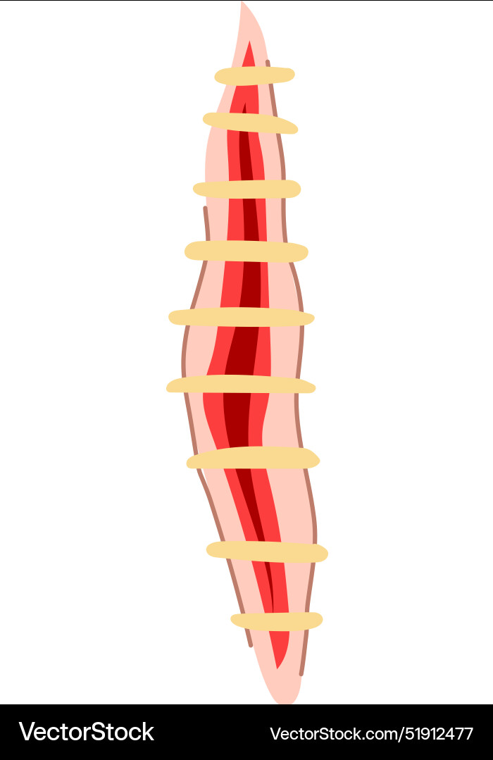 Cut suture cartoon Royalty Free Vector Image - VectorStock