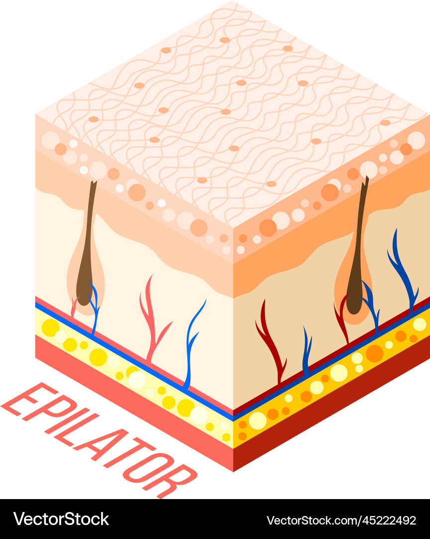 Epilator skin diagram composition Royalty Free Vector Image