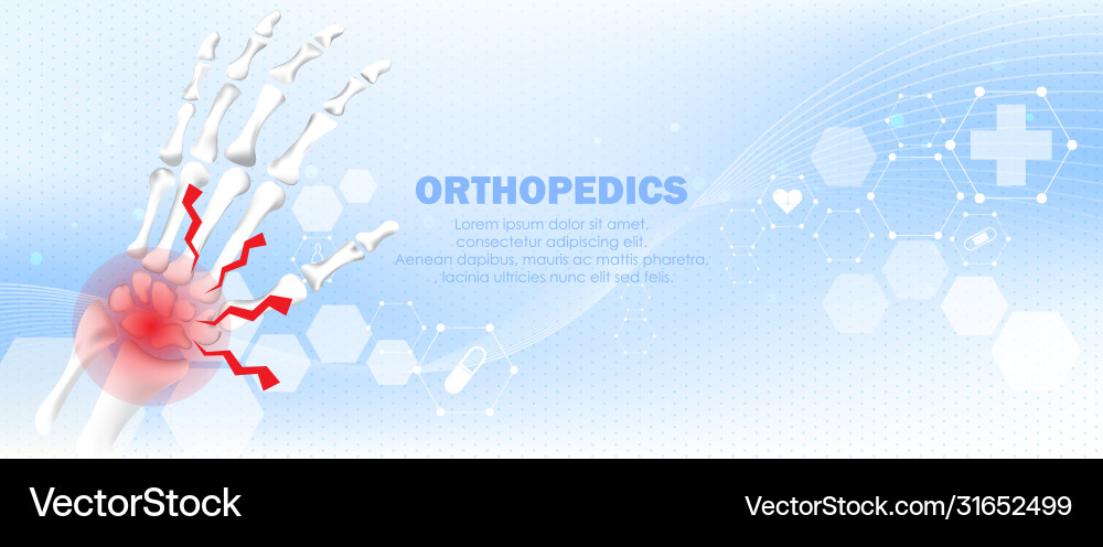 Orthopedics science wrist bone injury Royalty Free Vector