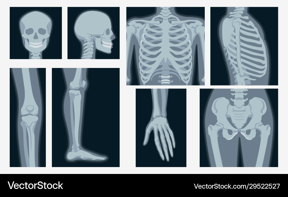 Different x-rays shot human body part set Vector Image
