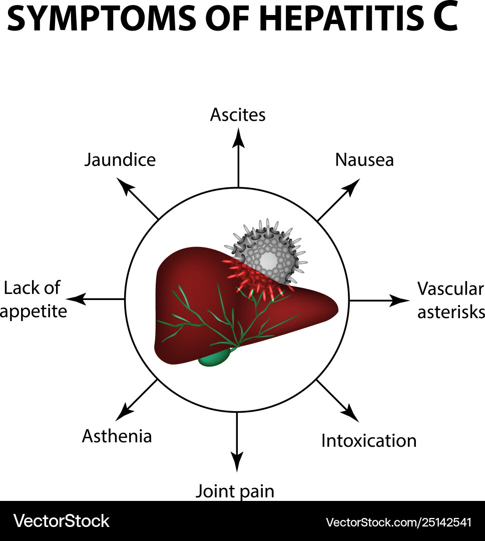 Hepatitis C Symptoms