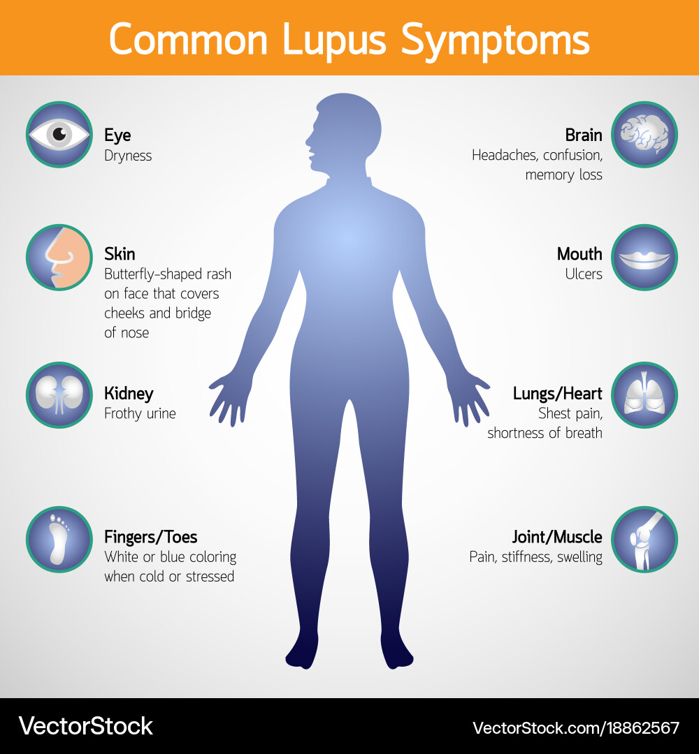 Common lupus symptoms logo icon Royalty Free Vector Image