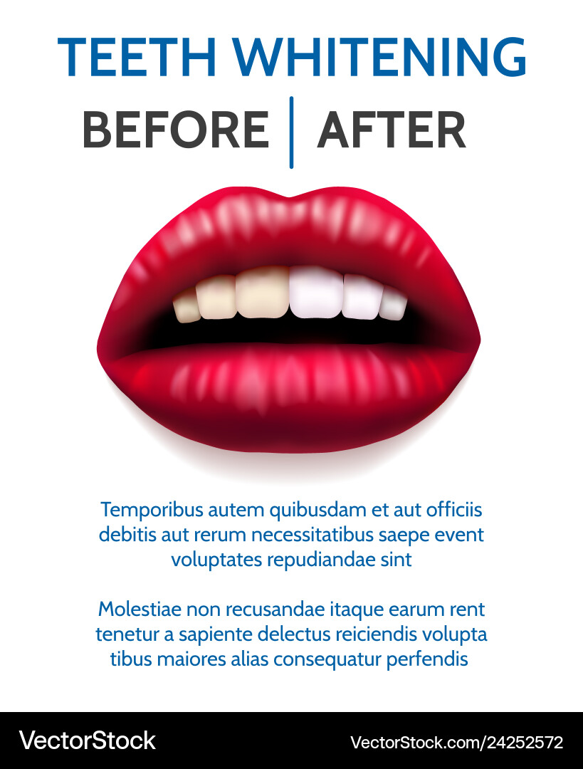 Teeth whitening poster Royalty Free Vector Image