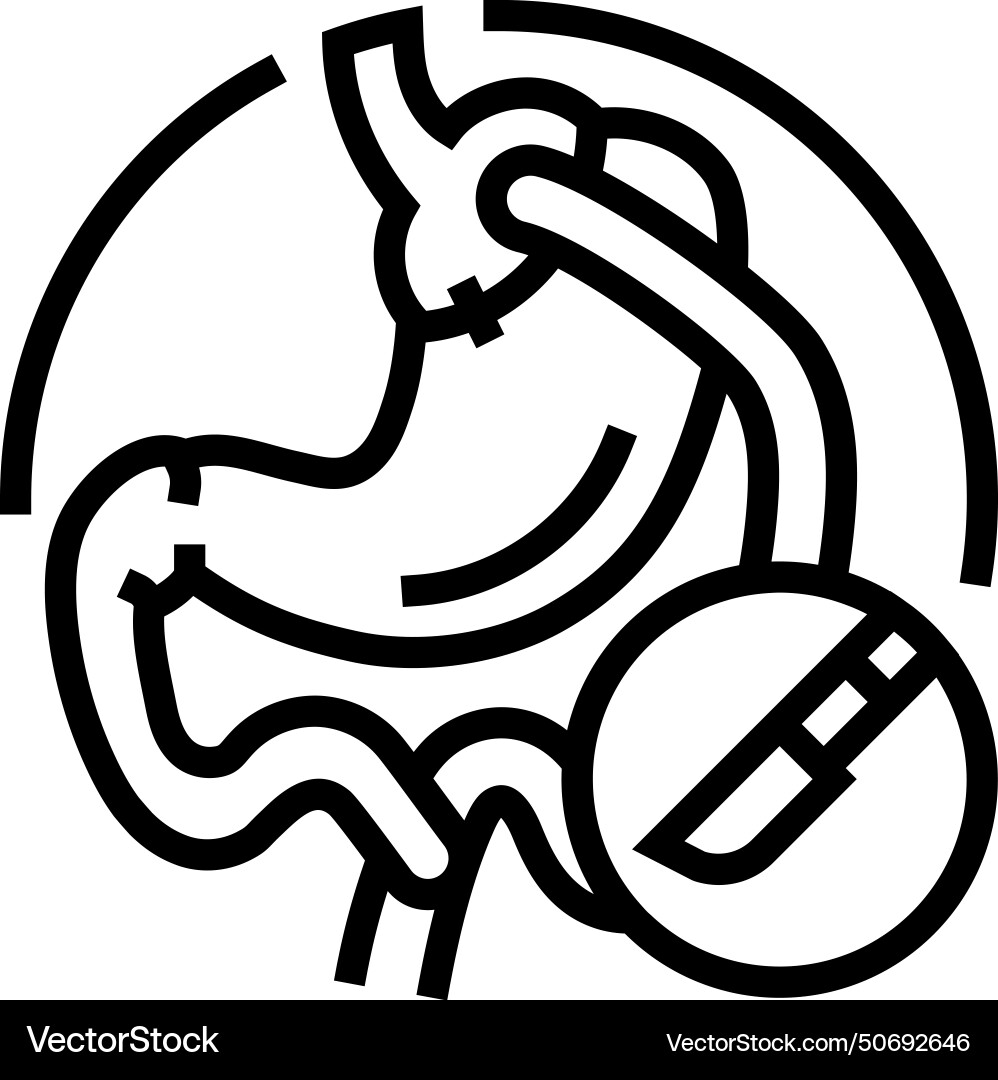 Gastric Bypass Surgery Line Icon Royalty Free Vector Image