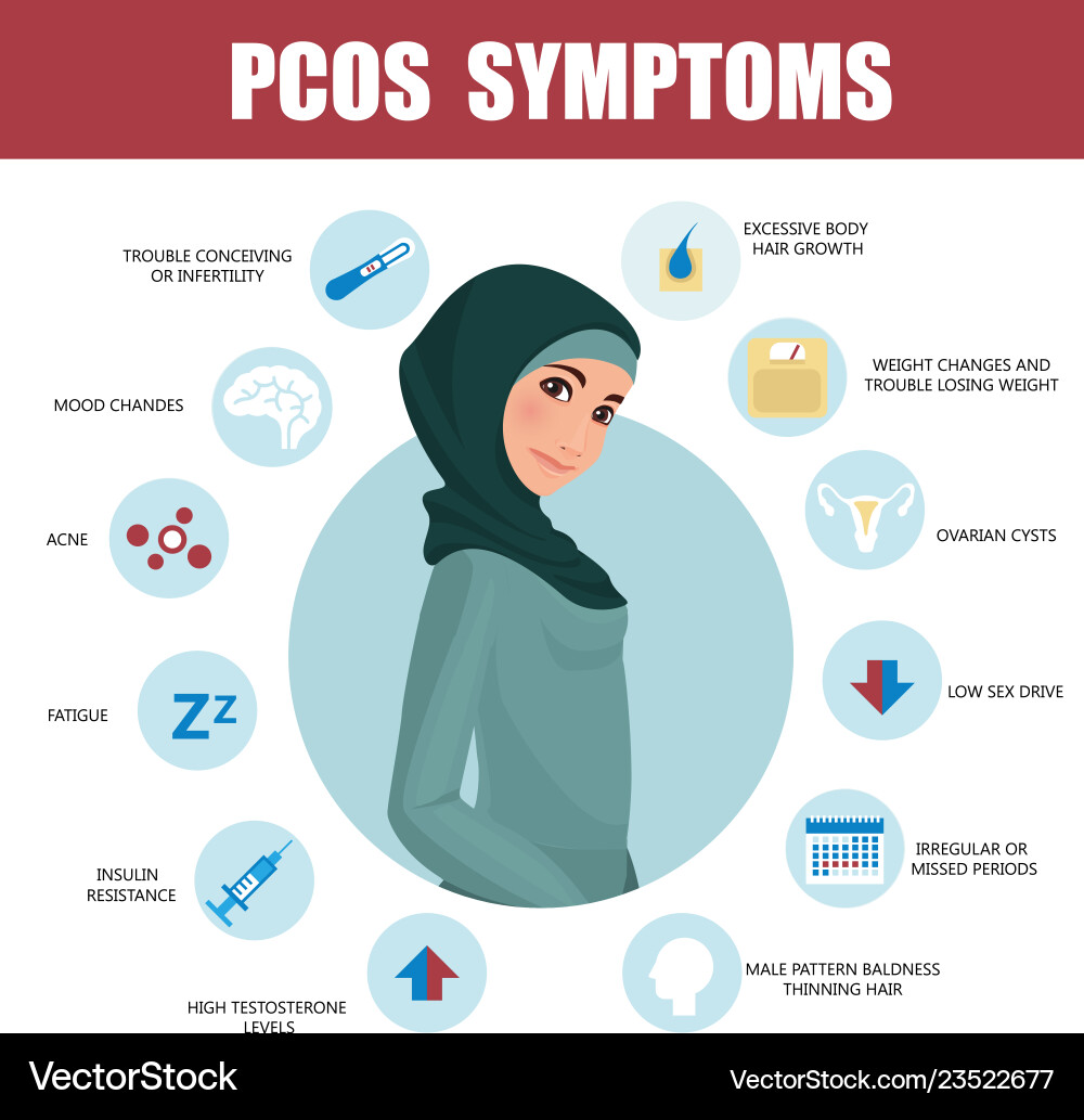 PCOS Symptoms - Detailed Infographic Royalty Free Vector