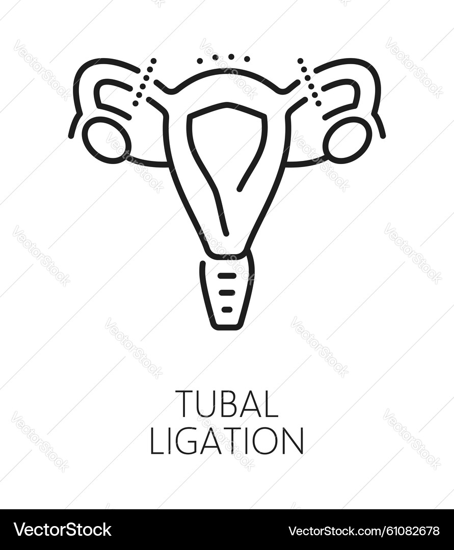 Tubal ligation Vector Images & Graphics for Commercial Use | VectorStock