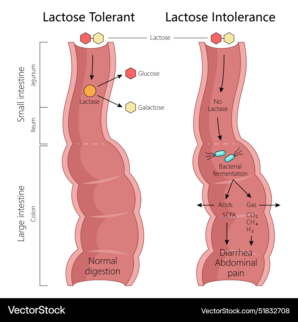 Lactose tolerance intolerance diagram medical Vector Image