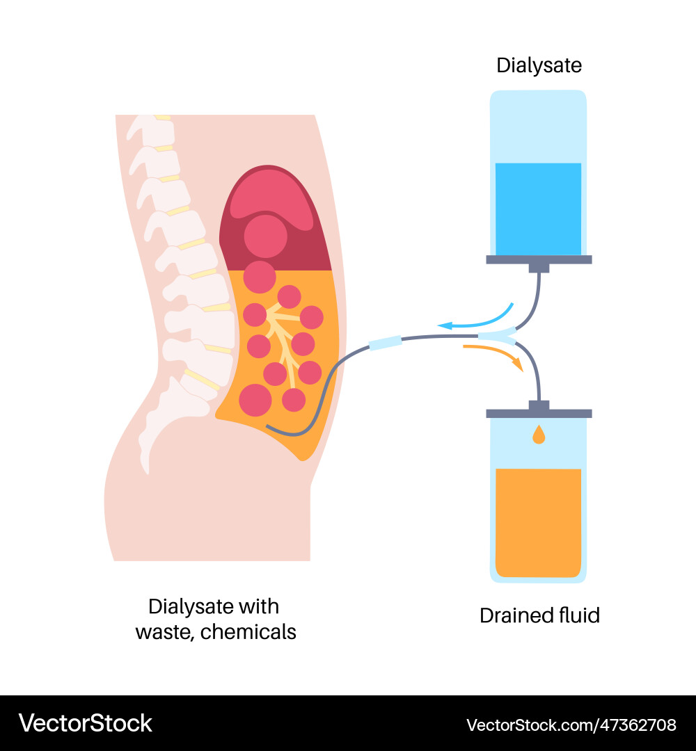Dialysis Vector Images (over 1,800)