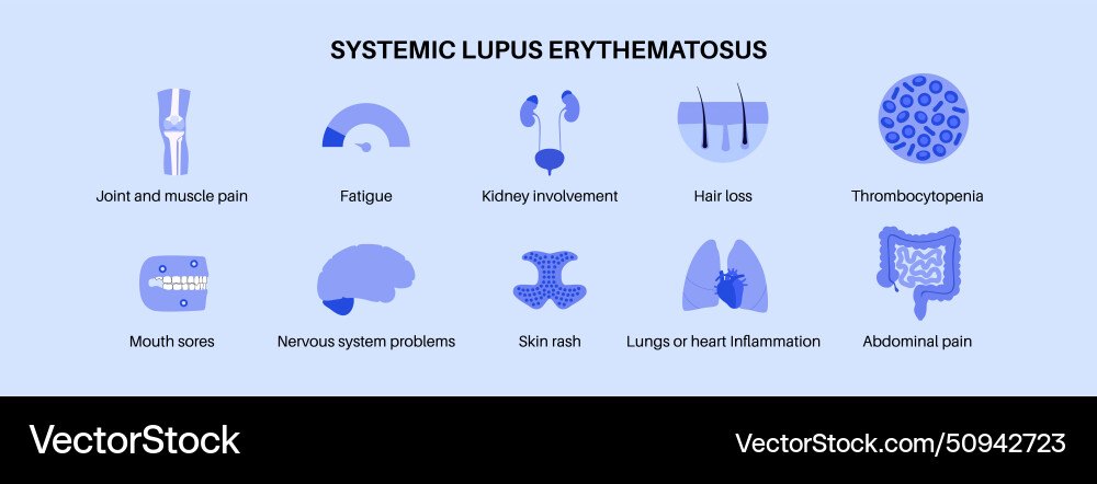 Systemic lupus erythematosus Royalty Free Vector Image