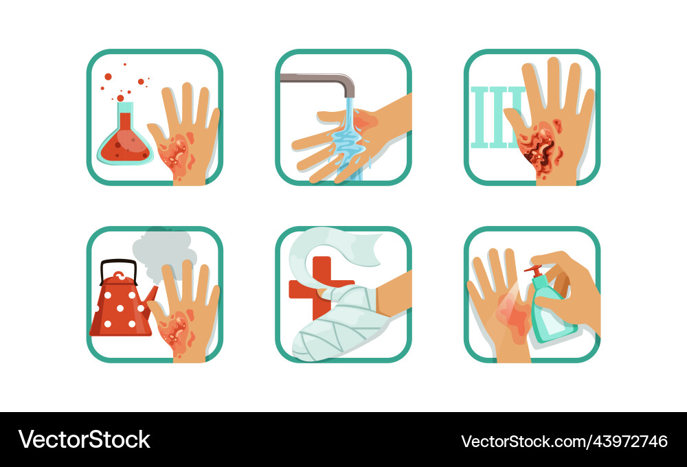 Scalding Vector Images (over 310)