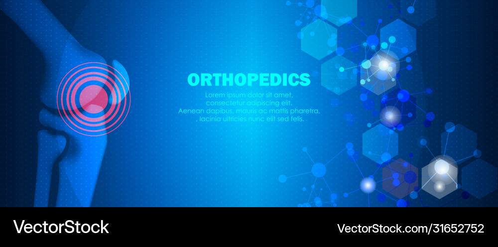 Medical orthopedic knee bone Royalty Free Vector Image