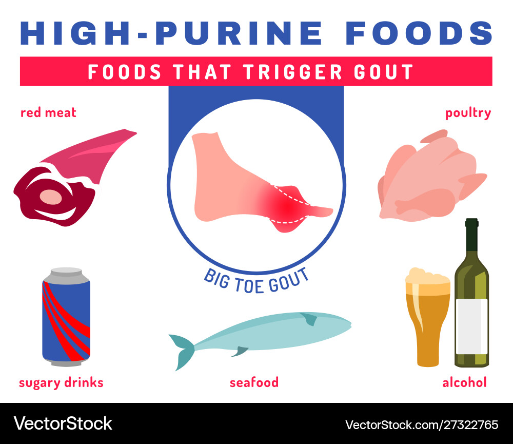 Gout infographic poster Royalty Free Vector Image