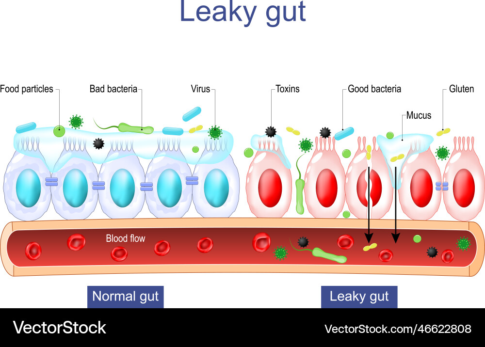 Leaky gut intestinal permeability barrier Vector Image
