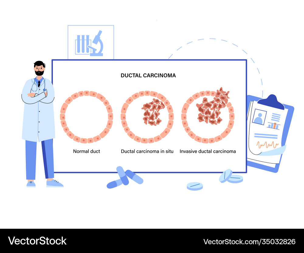 Stages of Breast Cancer Vector Images (68)