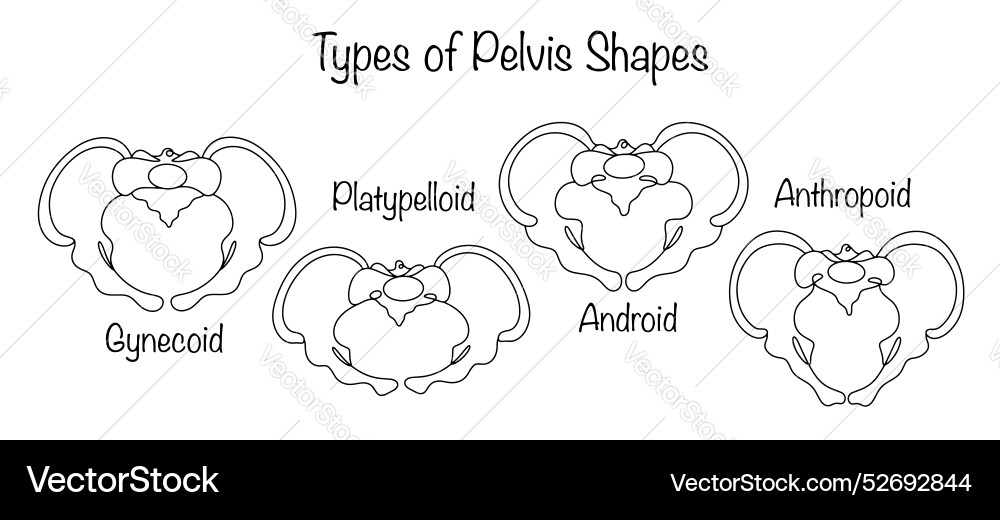 Types of pelvis shapes Royalty Free Vector Image