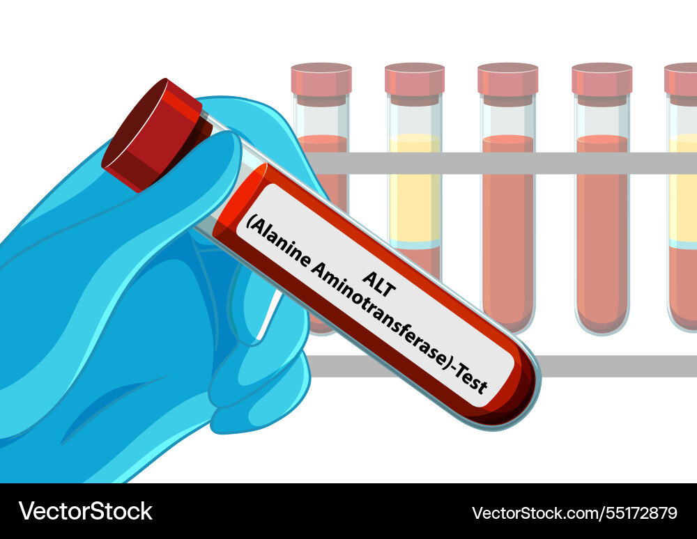 Hand holding blood sample for alt test Royalty Free Vector