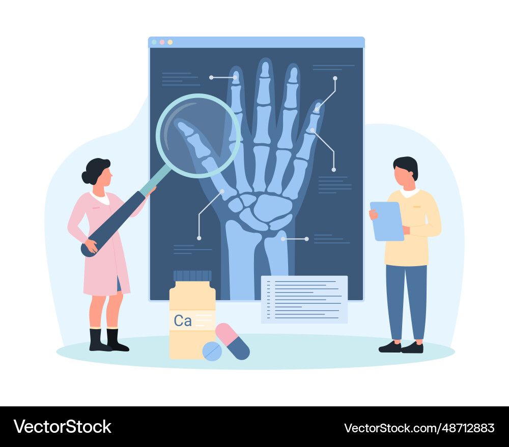 Diagnosis of osteoarthritis rheumatoid arthritis Vector Image