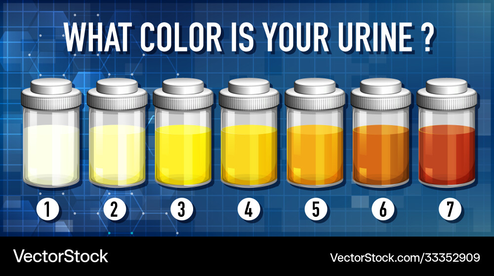 Urine Color Chart - Medical Guide – Royalty-Free Vector | VectorStock