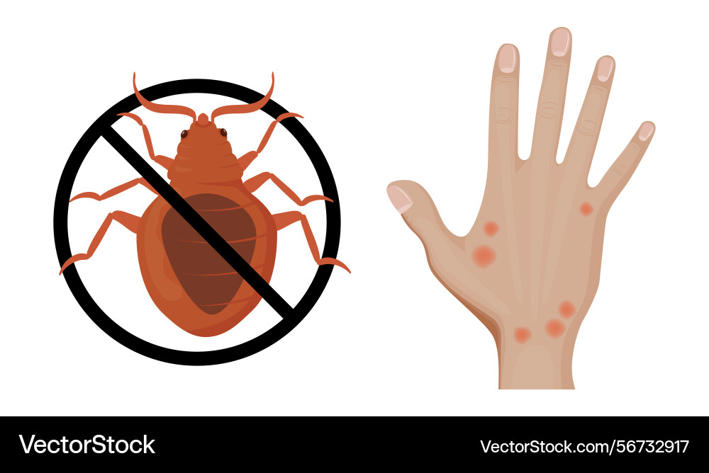 Stop bed bugs and skin rash caused by parasite Vector Image