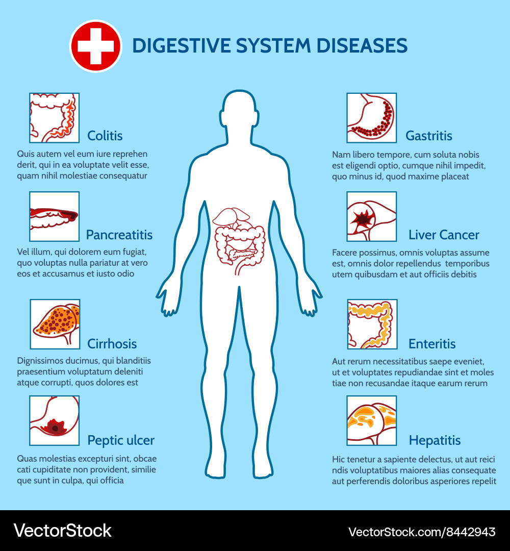 Digestive System Diseases - Medical Infographic Vector Image