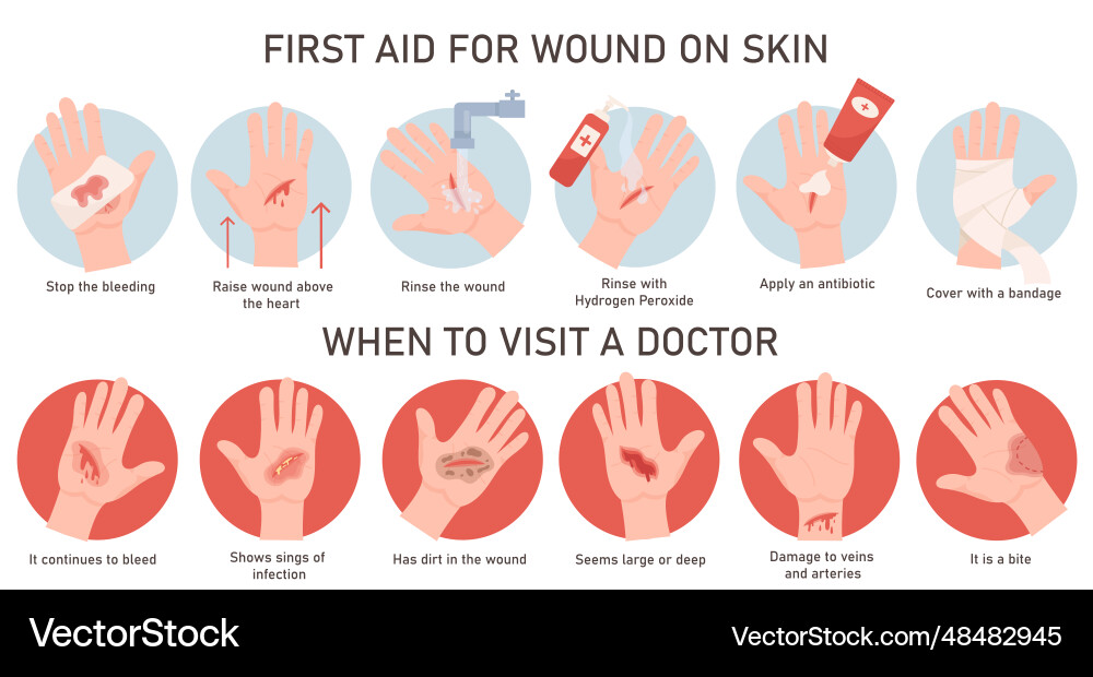 Hand Wound Care: First Aid & Treatment Vector Image