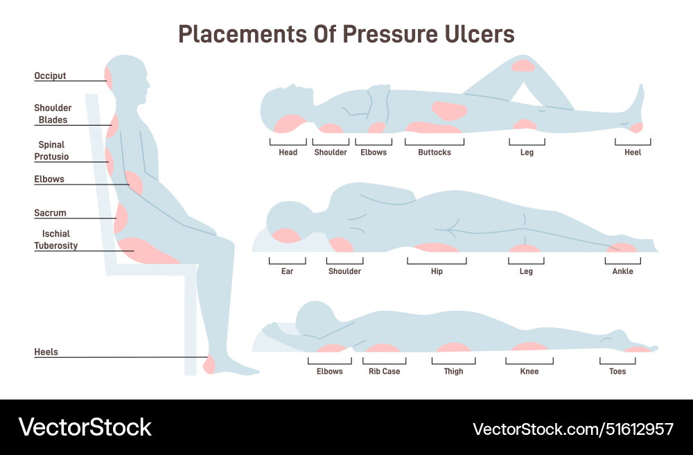 Anatomische Position Vector Images (über 400)