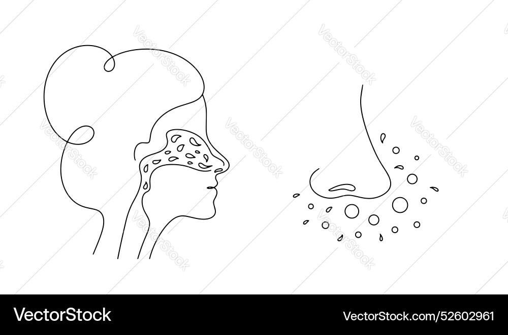 Rhinitis Royalty Free Vector Image - VectorStock