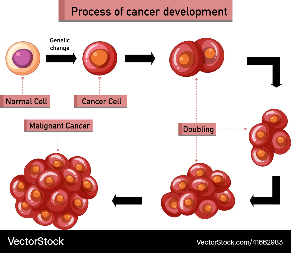 Process of cancer development infographic Vector Image