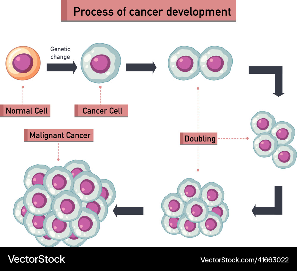 Process of cancer development infographic Vector Image