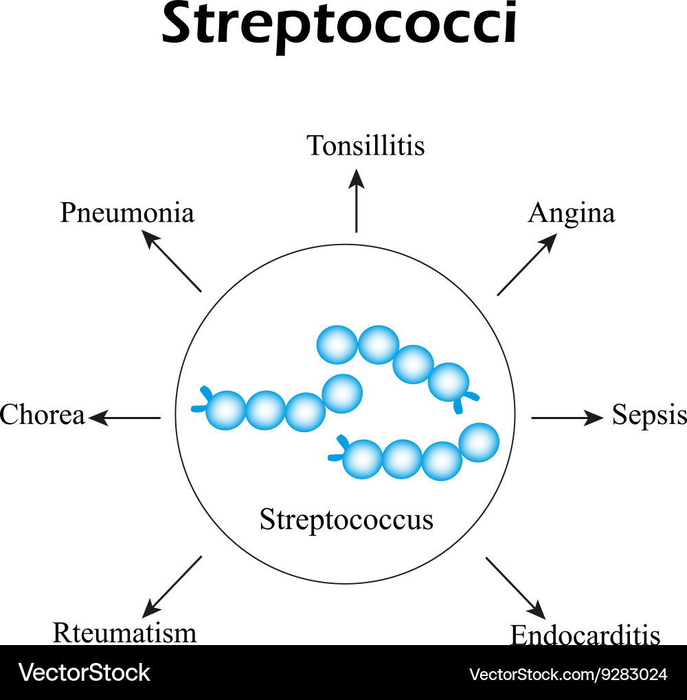 Streptococci streptococcal diseases infographics Vector Image